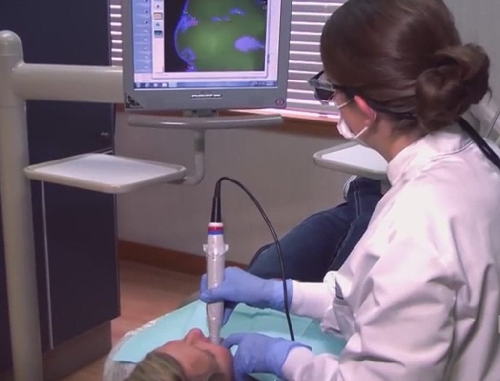 CamX Spectra Caries Detection Aid Archives - Air Techniques