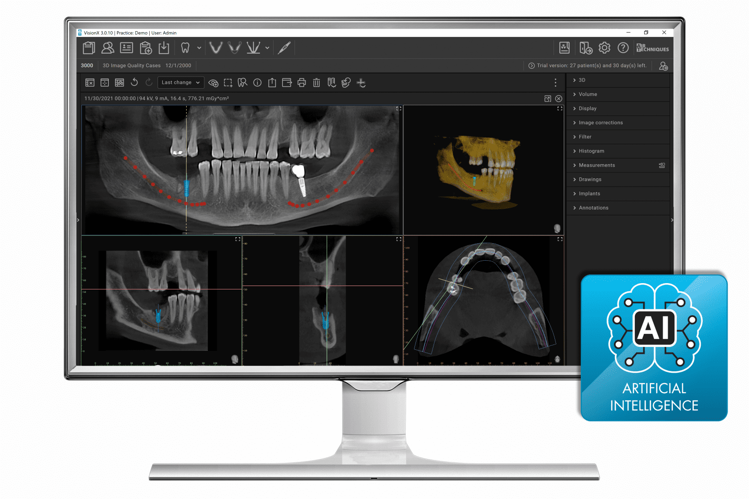 3D Prime CBCT - Air Techniques